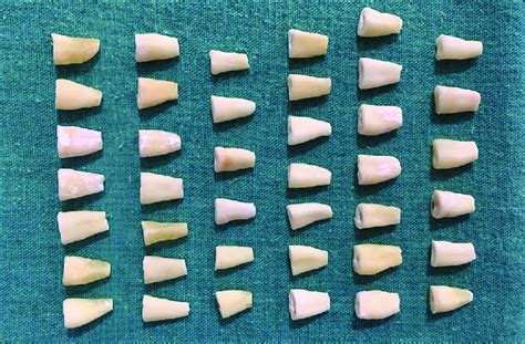 The 12mm Length Specimens With Simulated Open Apices Download