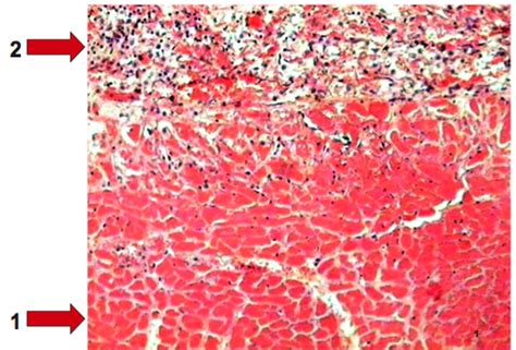 Reversible And Irreversible Cell Injury Practical Karteikarten Quizlet