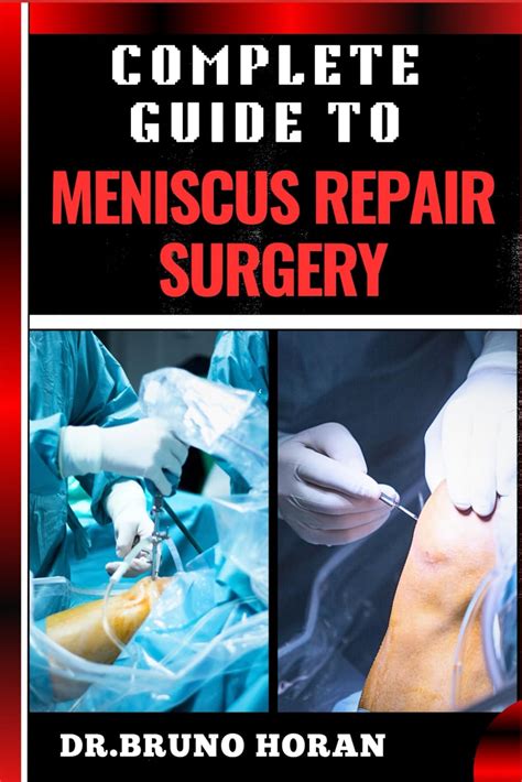 Complete Guide To Meniscus Repair Surgery Essential Handbook To