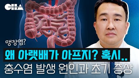 충수염 맹장염 자가진단할 수 있는 초기 증상과 발병 원인은 급성and만성 비교 Youtube