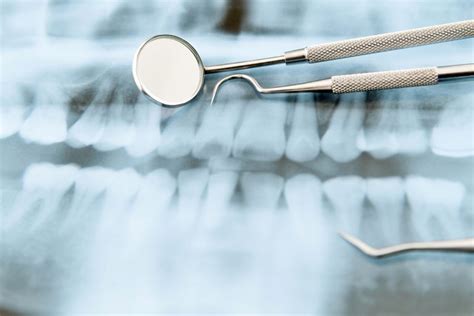 What Causes Root Resorption In Teeth Edmond Ok