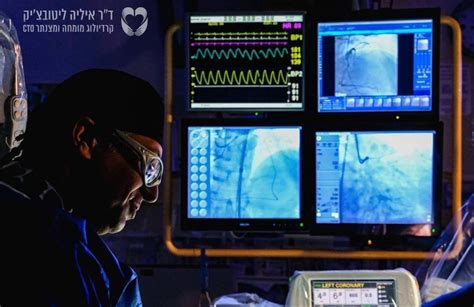 איך מתבצע צנתור לב מידע למטופלים