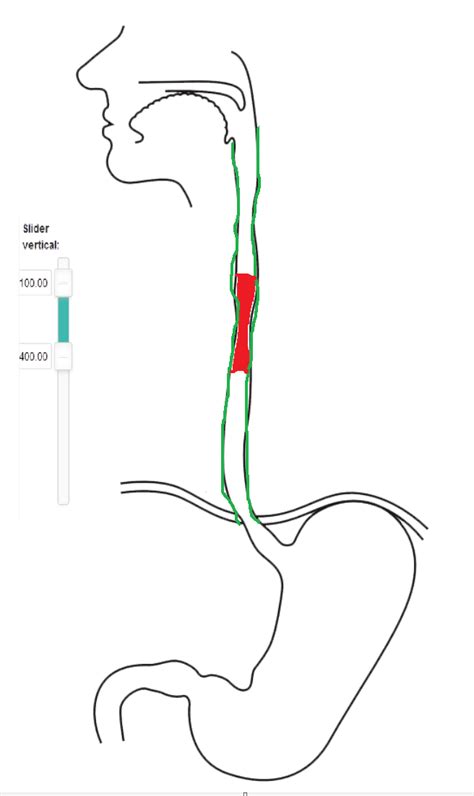 R How To Get The X Y Coordinates From A Line Of A Png Image And Use It In A Shiny App Stack