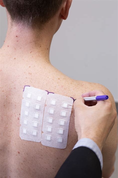 Contact Welcome To The Contact Dermatitis Institute Were Here To