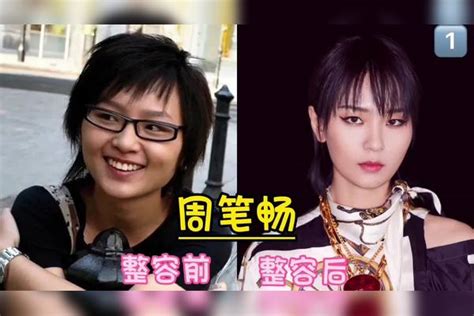 当红女星整容前后对比杨幂赵丽颖堪称完美杨颖整完人生开挂