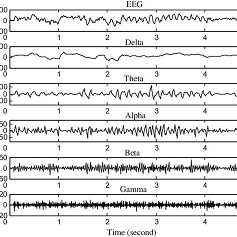 pdf classification of eeg signals for detection of epileptic seizures based on wavelets and