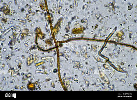 Fungal And Fungi Hyphae Under The Microscope In The Soil And Compost