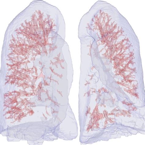 A 69 Year Old Woman Was Diagnosed With Ipf With A Probable Uip Pattern