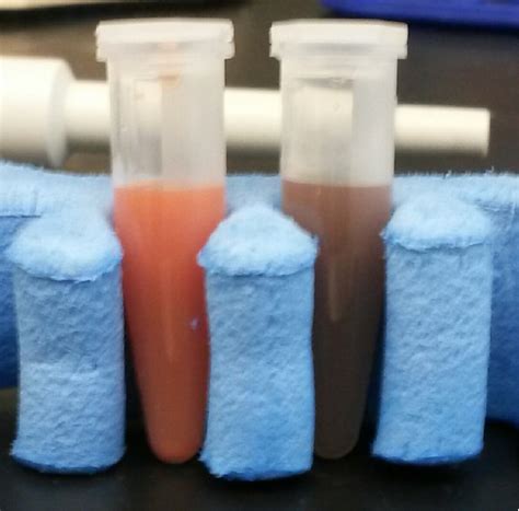 Figure 1 From The Effect Of Red Allotrope Selenium Nanoparticles On