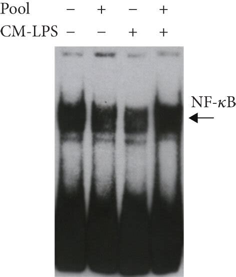 Effect Of Antioxidants On Neuronal Nf κb Binding Activity Ad Emsa Download Scientific