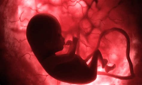 பனிக்குட நீர் குறைவாக இருந்தால் என்ன ஆகும்what Happens If The Amniotic