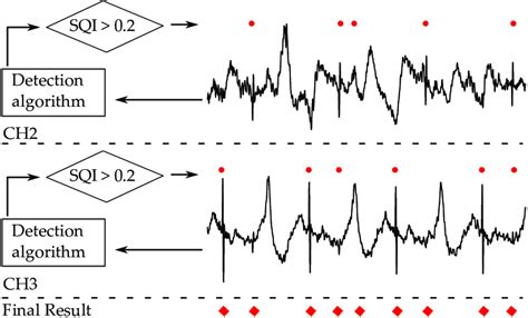 Illustration Of The Overall Fusion Algorithm For The Detection Of The