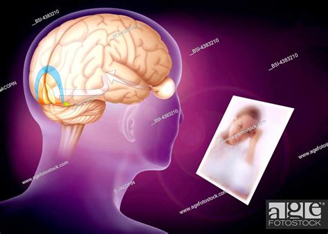 Visual Cortex Stock Photo Picture And Rights Managed Image Pic BSI 4383210 Agefotostock