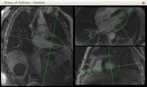 Orthanc Dicom Server