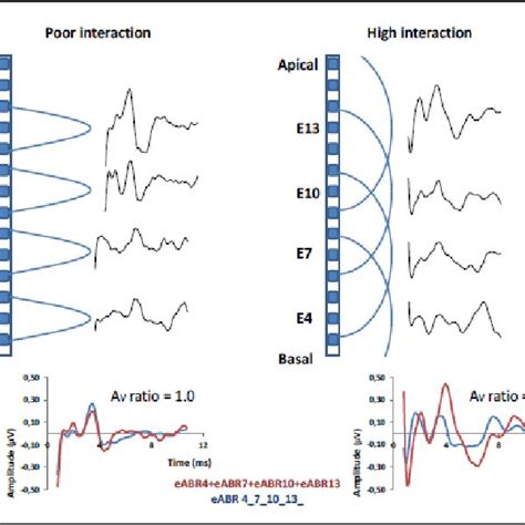 Abr Waveforms And Recoding Electrodes Placement [18] Download Scientific Diagram