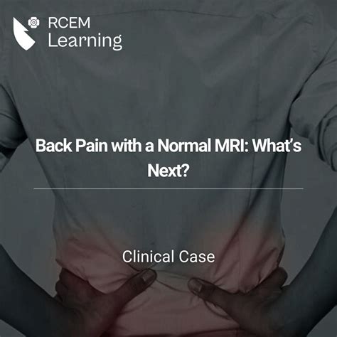Rcemlearning New Read Our Clinicalcase Here