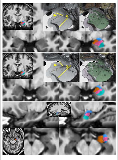 Figure From A D Fully Convolutional Neural Network With Top Down Attention Guided Refinement