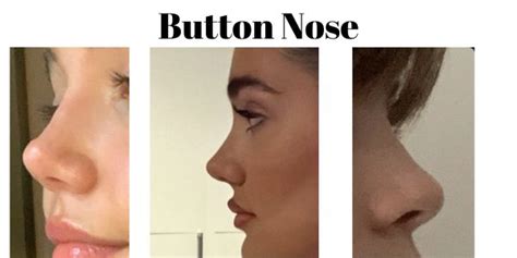 Complete Guide About Button Nose Features Personality Type