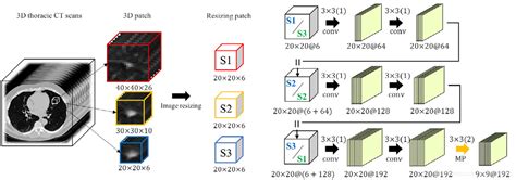 基于深度学习的肺部ct影像识别——采用u Net、3d Cnn、cgan实现肺结节的检测（二）csdn 肺结节检测 Csdn博客