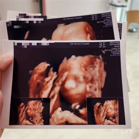 임신일기 아인병원 25주 임산부 임당검사 입체초음파 후기 네이버 블로그