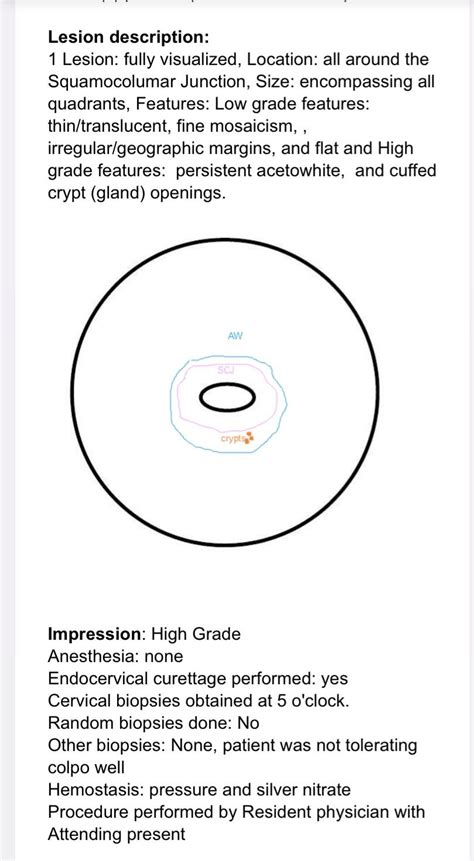 Decoding Colposcopy Results Rhpvandcervixcancer