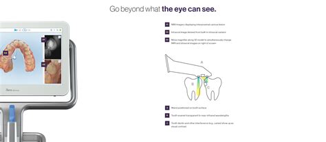 ITero Element D Southwest Family Dentistry
