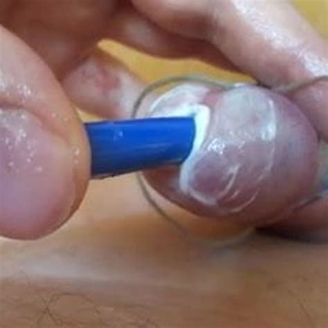 Penis Insertion Torture Closeup Cock Painful Schmerz 2 Xhamster