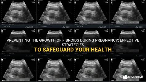 Preventing The Growth Of Fibroids During Pregnancy Effective