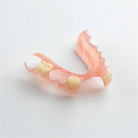 Essix Retainer With Tooth Vs Flipper Dental Lab Direct