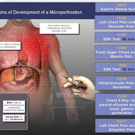 Medical Legal Exhibits Legal Animations Trial Graphics