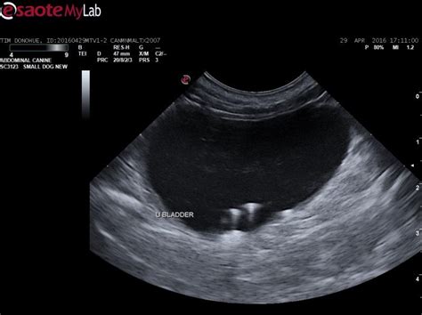 Prostatic Calcification Members