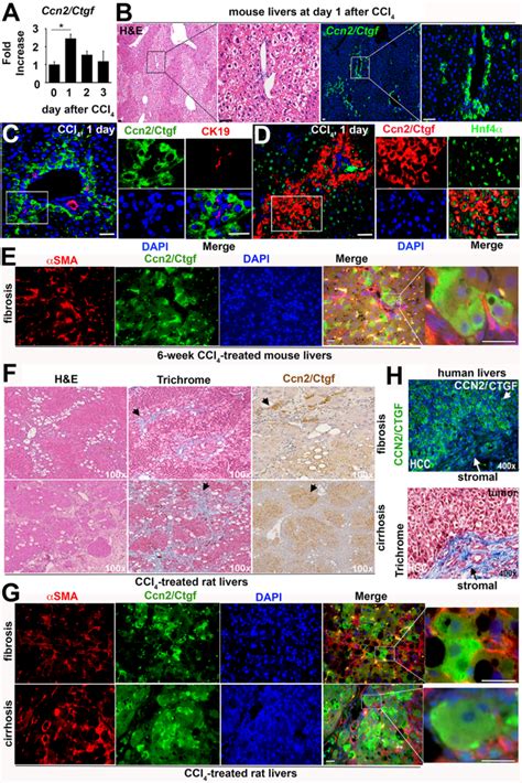 CCN2 CTGF 通过与 Slit2 Robo 信号串扰促进肝纤维化 Journal of Cell Communication and