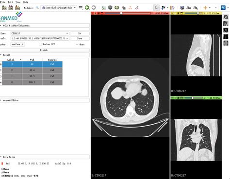 When Importing Data On 3dslicer Version 50 The Data Displayed Is