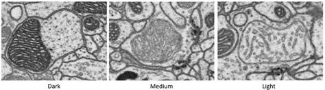 Mitochondria Types Images Here Are Were Taken At 4 Nmpixel Left