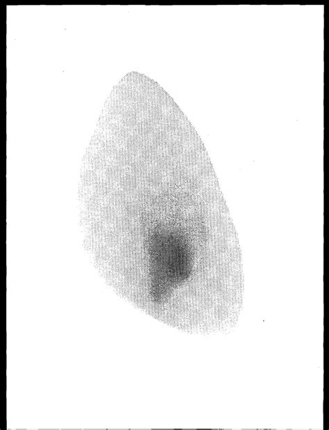 4 Rendering Of The Anatomical Strucm The Phong Shading Model Has Been Download Scientific