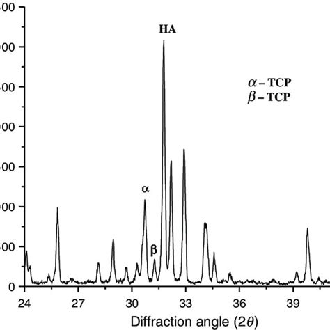 X Ray Diffraction Of Bonelike Õ Graft Which Is Composed Of Ha And Tcp