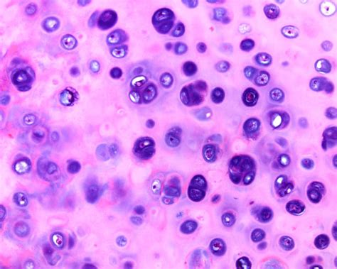 Hyaline Cartilage 400x Labeled