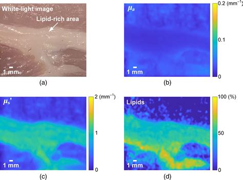 Quantitative Spatial Mapping Of Tissue Water And Lipid Content Using Spatial Frequency Domain