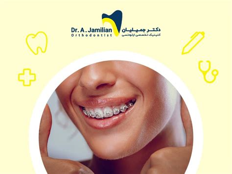 How To Remove Orthodontic Brackets Dr Jamilian
