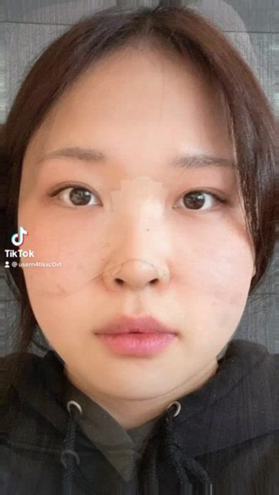 코성형 고민이라면 아묻따 👍👍👍👍 유명연예인들 셀럽 아나운서들이 입소문으로 믿고 진료받는 스페셜👏👏 건강하고 아름다운 코성형코질환에 대한 모든것 이젠 7000