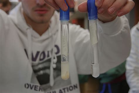 Bioprospecting For Cellulose Degrading Microbes Filter Paper Assay