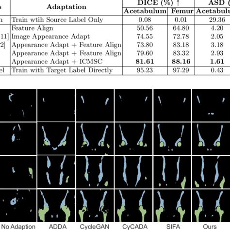 Quantitative Comparative Results Between Our Method And Other State Of Download Scientific