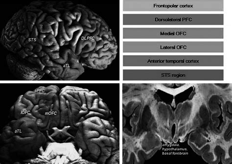 Brain Regions Implicated In Human Moral Cognition Adapted From Moll Download Scientific