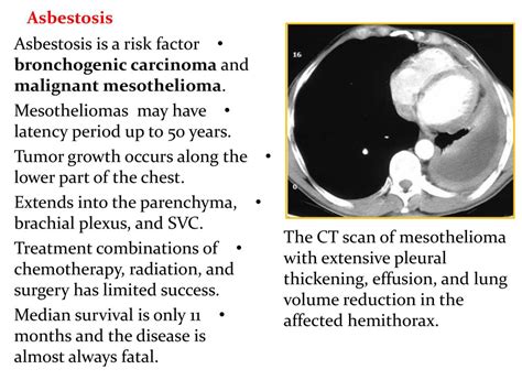 Rhumatoid Arthritis Ppt Download
