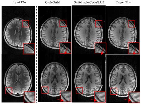 Diagnostics Free Full Text Multi Contrast Mri Image Synthesis Using