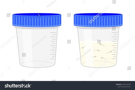 Semen Analysis Sperm Sample Plastic Container Stock Vector Royalty Free 1950144328 Shutterstock