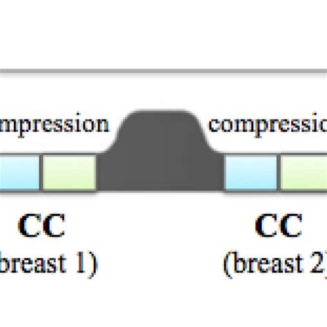 Cesm Examination The Diagram Shows The Steps Of The Image Acquisition