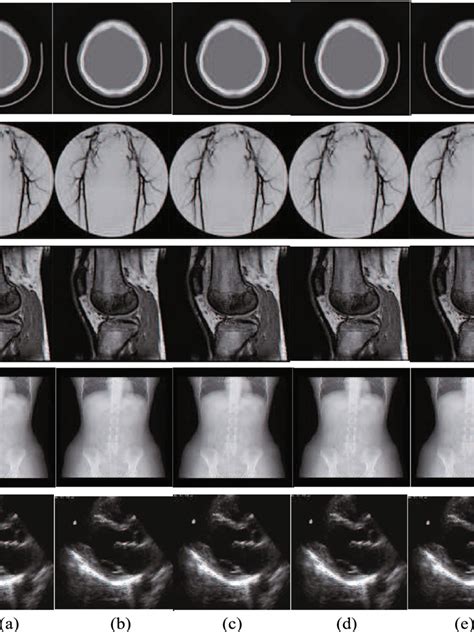 Decrypted Images With Different Schemes Download Scientific Diagram
