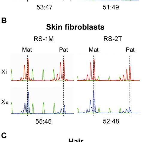 X Chromosome Inactivation Analyses Xi X Inactivation Pattern Based On Download Scientific