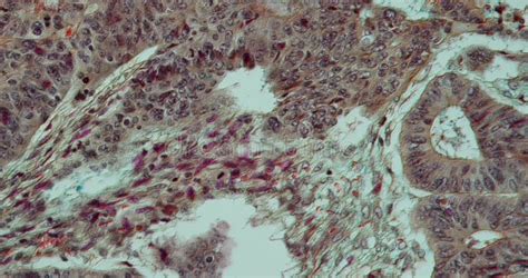 Large Intestine Of Human Being In Section Magnified Under Microscope In